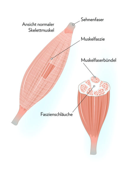 Muskelfaserriss: Immobilisation oder Training? • Leistungslust